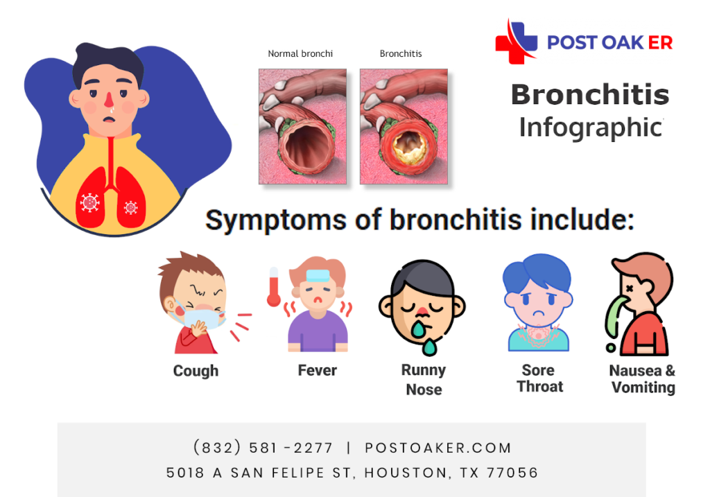 Is Bronchitis Contagious Acute Chronic Bronchitis Post Oak ER Is Bronchitis Contagious Acute Chronic Bronchitis Post Oak ER