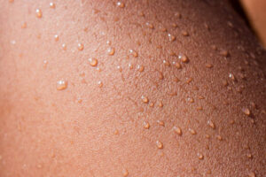Clammy Skin: Causes, Symptoms, and When to Seek Care