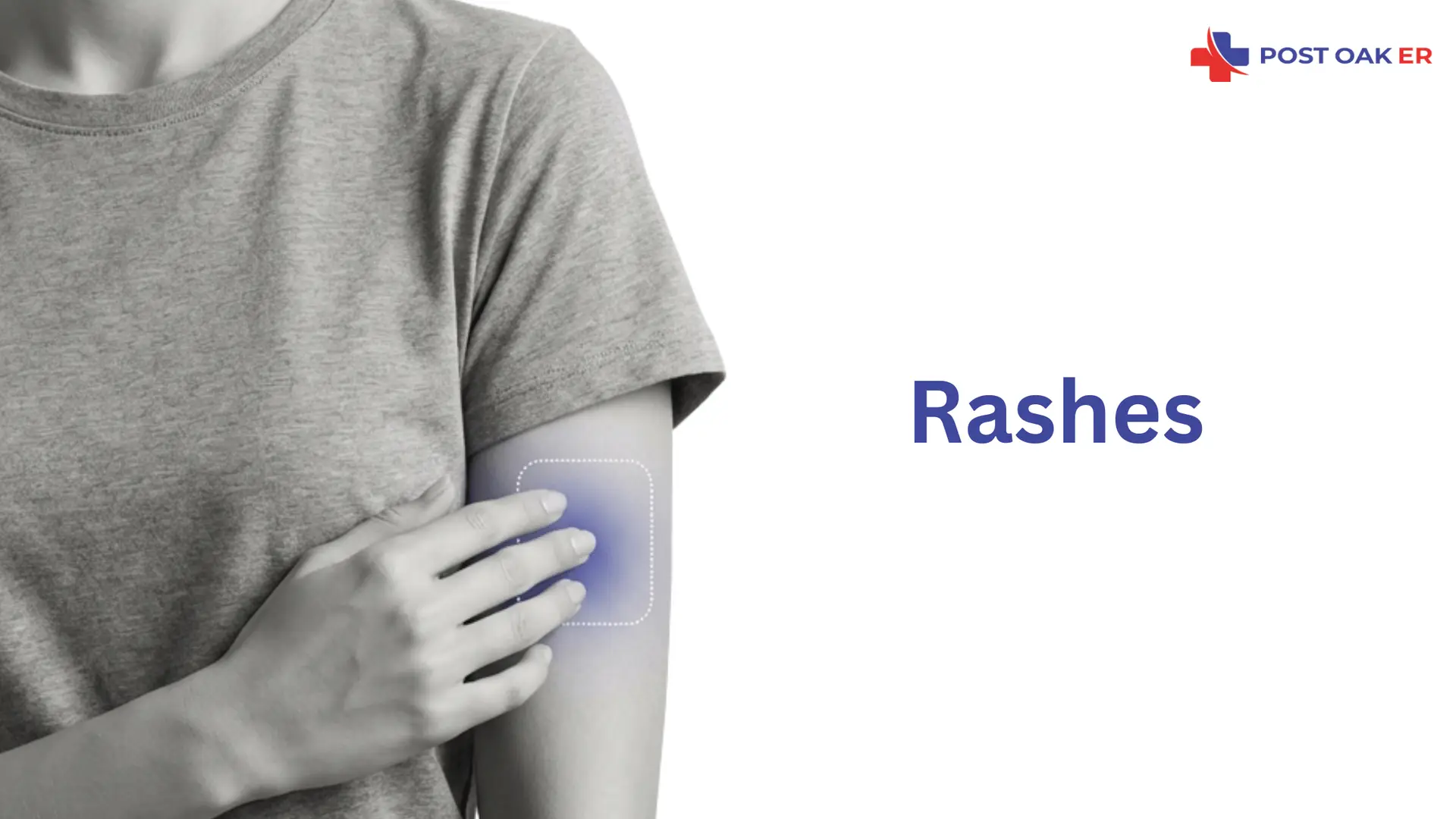 When to Go to the ER for a Rash | Post Oak ER Houston